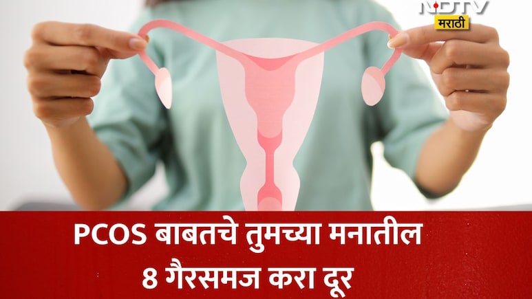 pcos myths and facts explained 8 misconceptions by dr padma srivastava ...