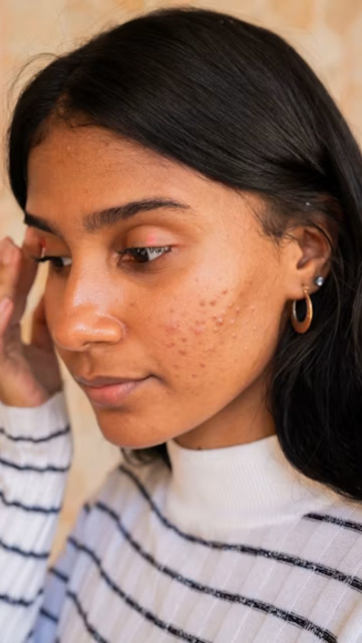 7 Foods That Affect Your Skin Health 7 Foods That Affect Your Skin Health