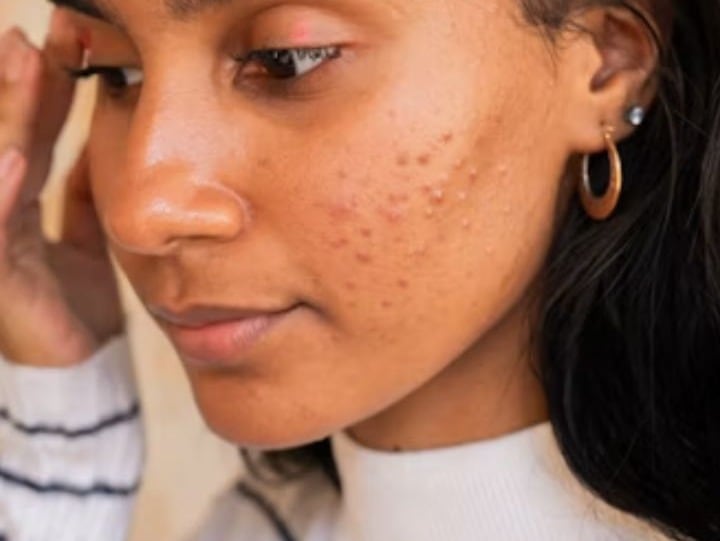 7 Foods That Affect Your Skin Health