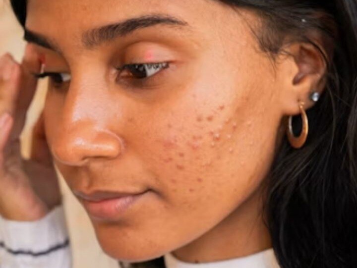 7 Foods That Affect Your Skin Health 7 Foods That Affect Your Skin Health