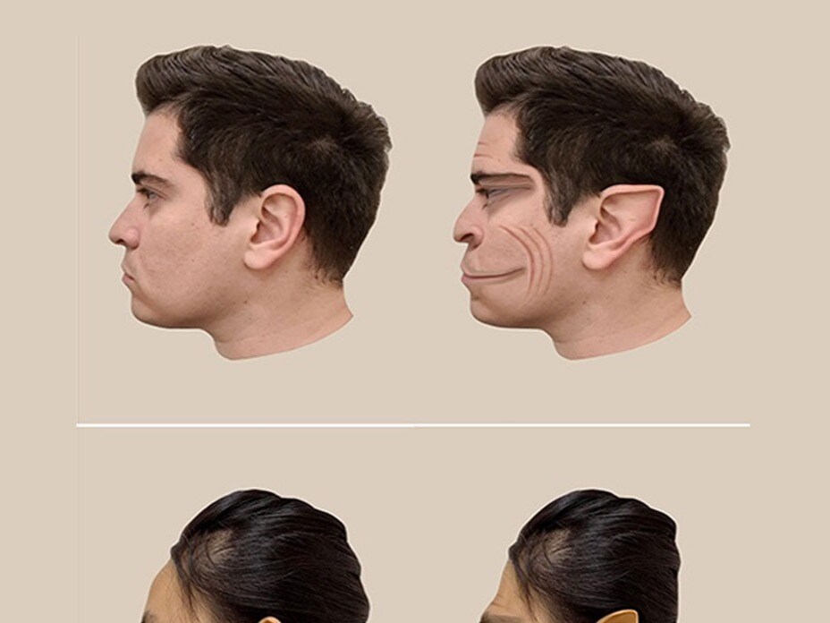 All About "Demon Face Syndrome"