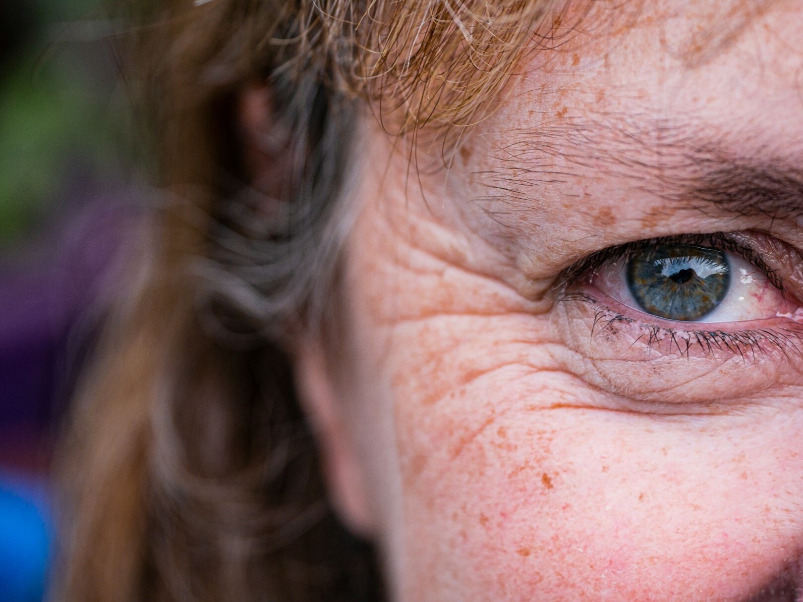 Common Factors That Cause Skin Ageing