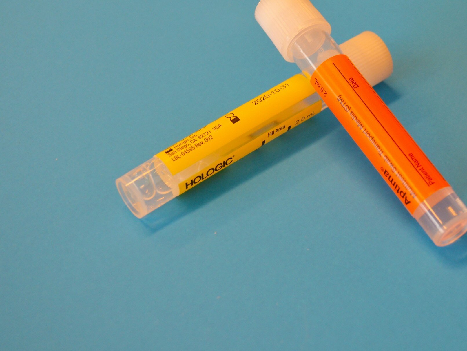 Early Signs Of High Uric Acid Levels