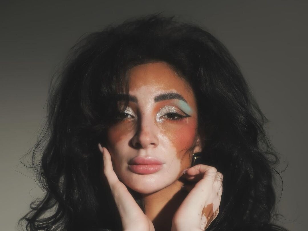 Miss Egypt's Historic Miss Universe Moment With Vitiligo