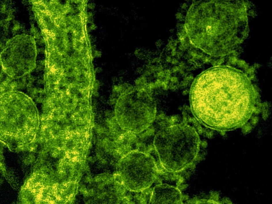 Mysterious Virus-Like Life Form Found In Humans