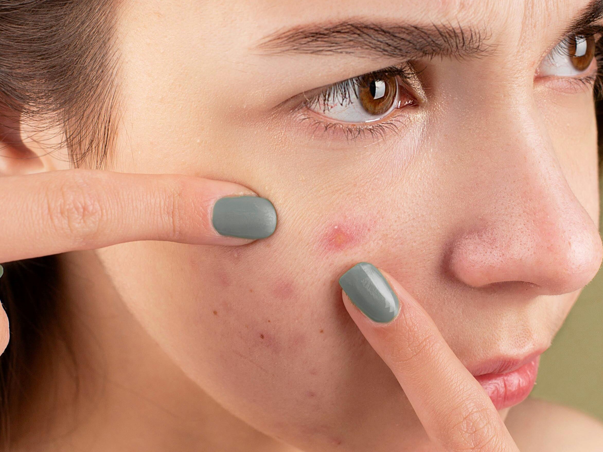 Signs Of Silent Inflammation