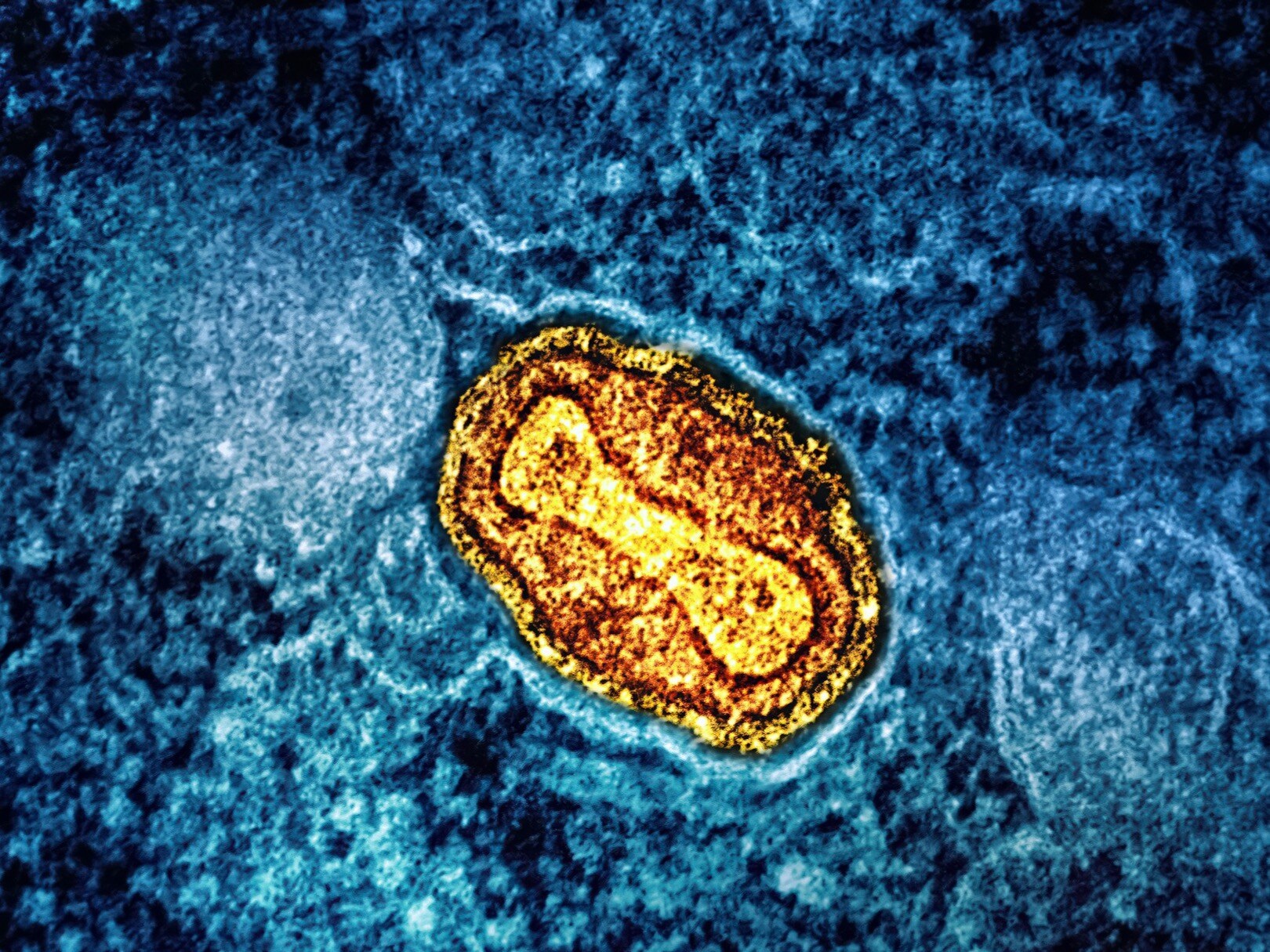 Symptoms Of Mpox Virus