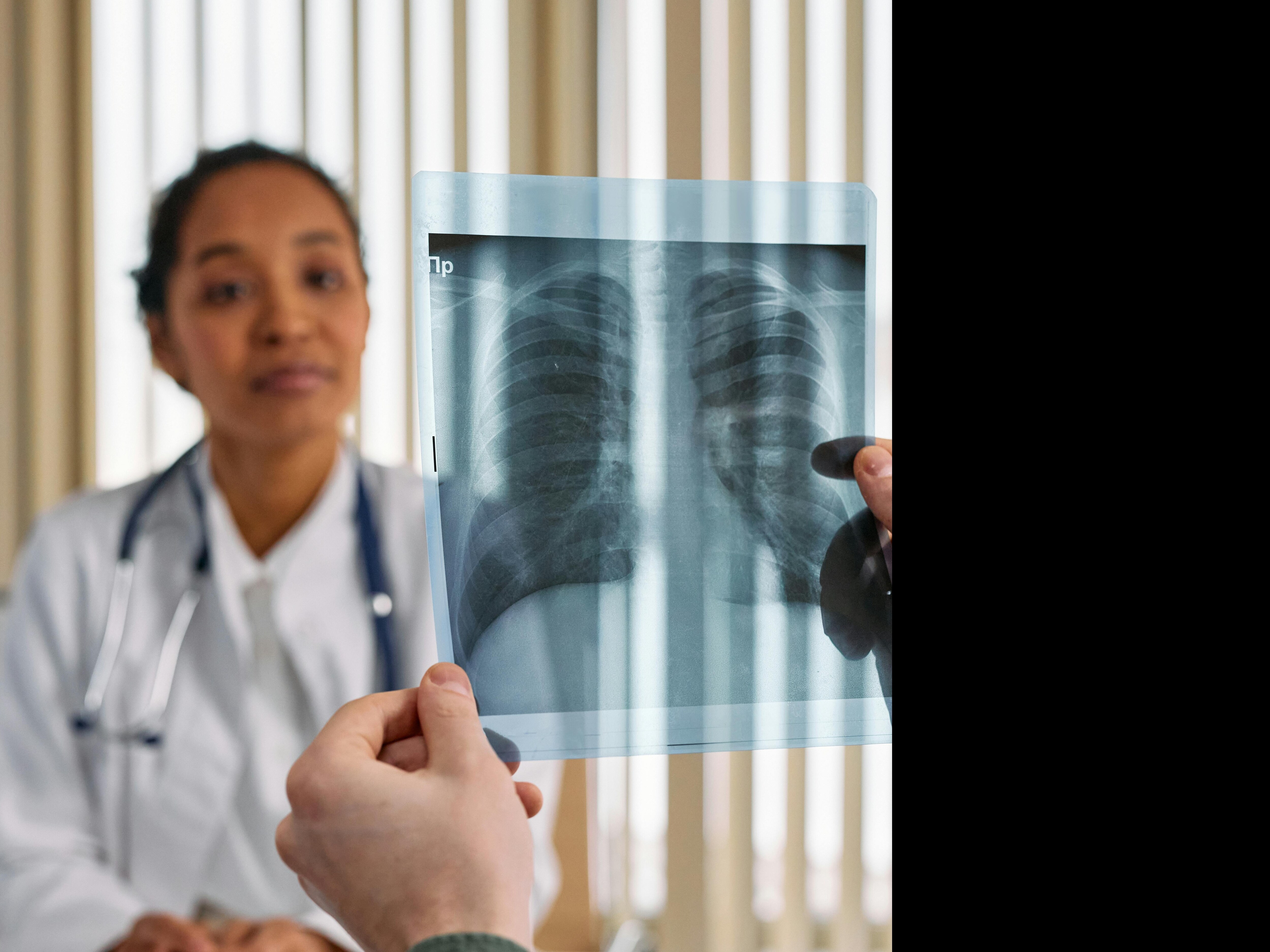 World TB Day 2024: Tips To Lower Your Risk Of Tuberculosis