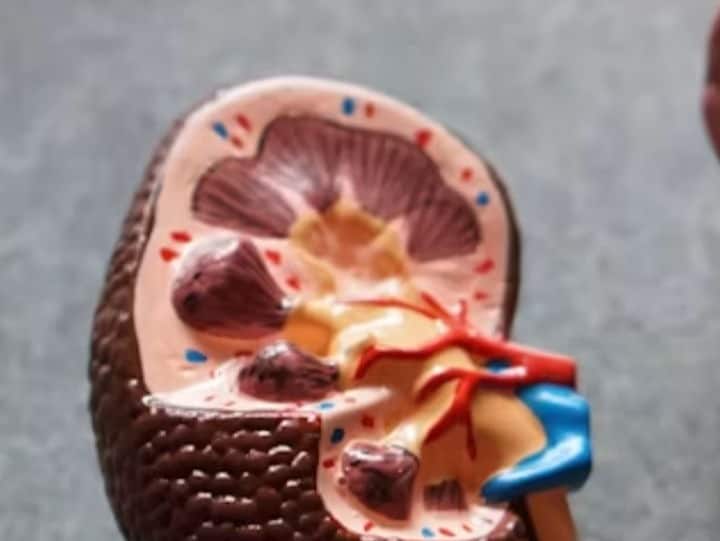 Ways To Reduce Creatinine Levels