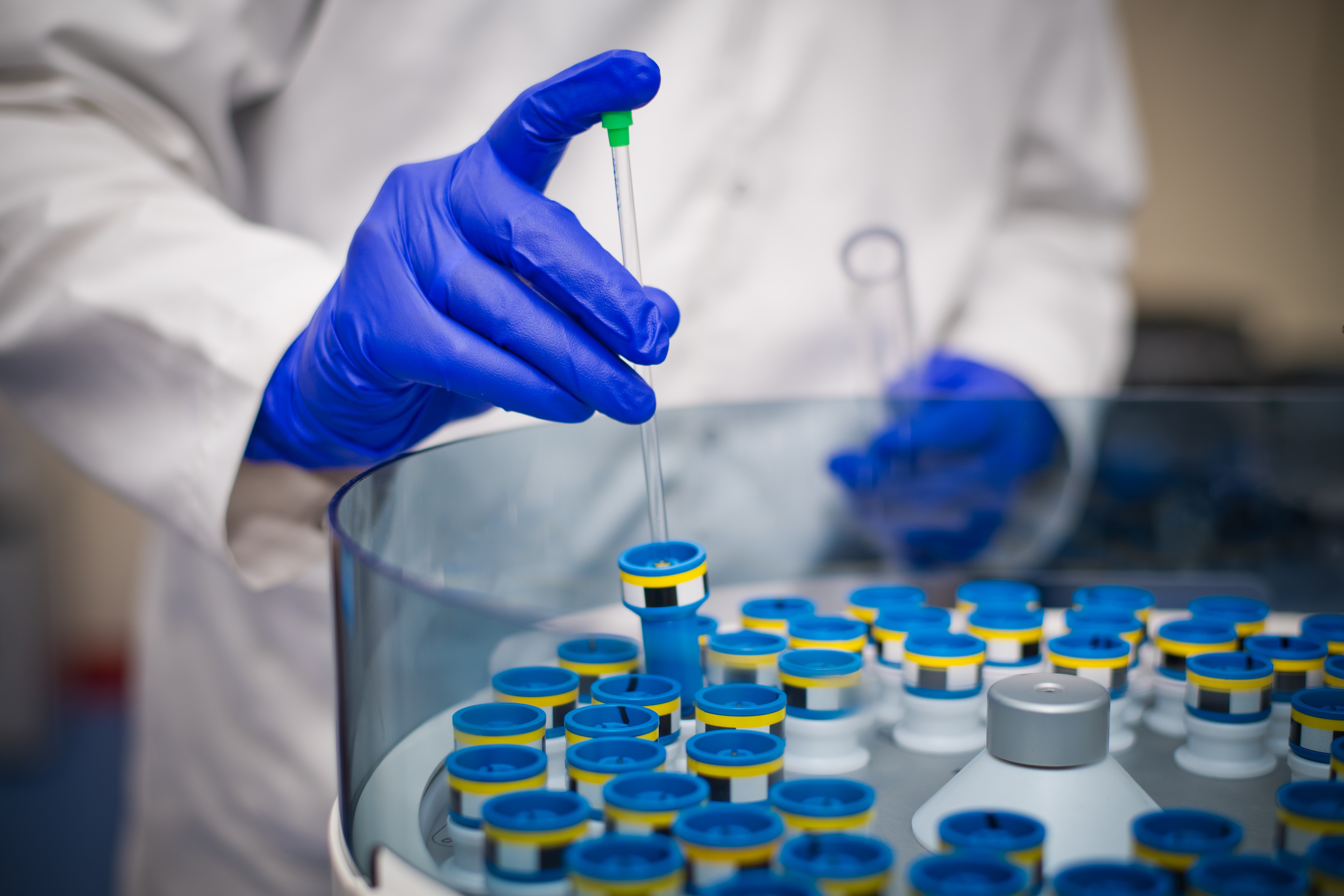 Biocon Gets Four Observations From U.S. FDA For Bengaluru API Facility